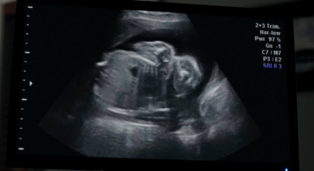 Siren— SEASON 2 FINALE: “New World Order” – Father Son Holy Gore